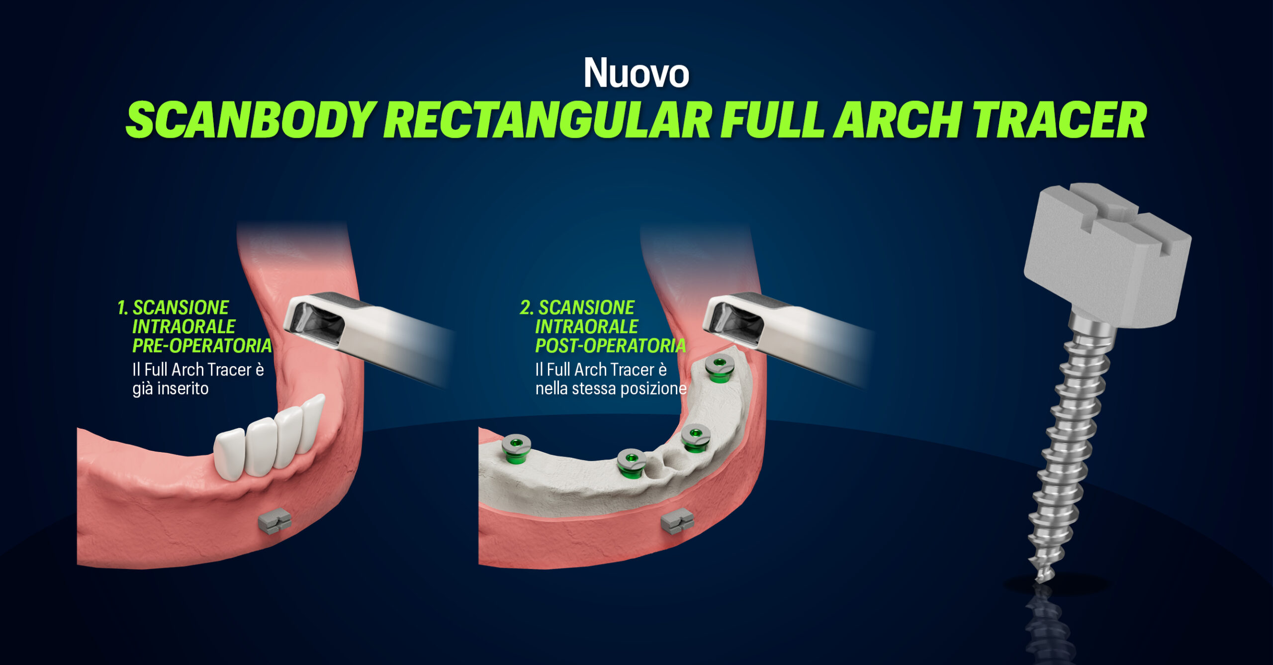 JD PROMO - ScanBody Rectangular Full Arch Tracer - JDentalCare