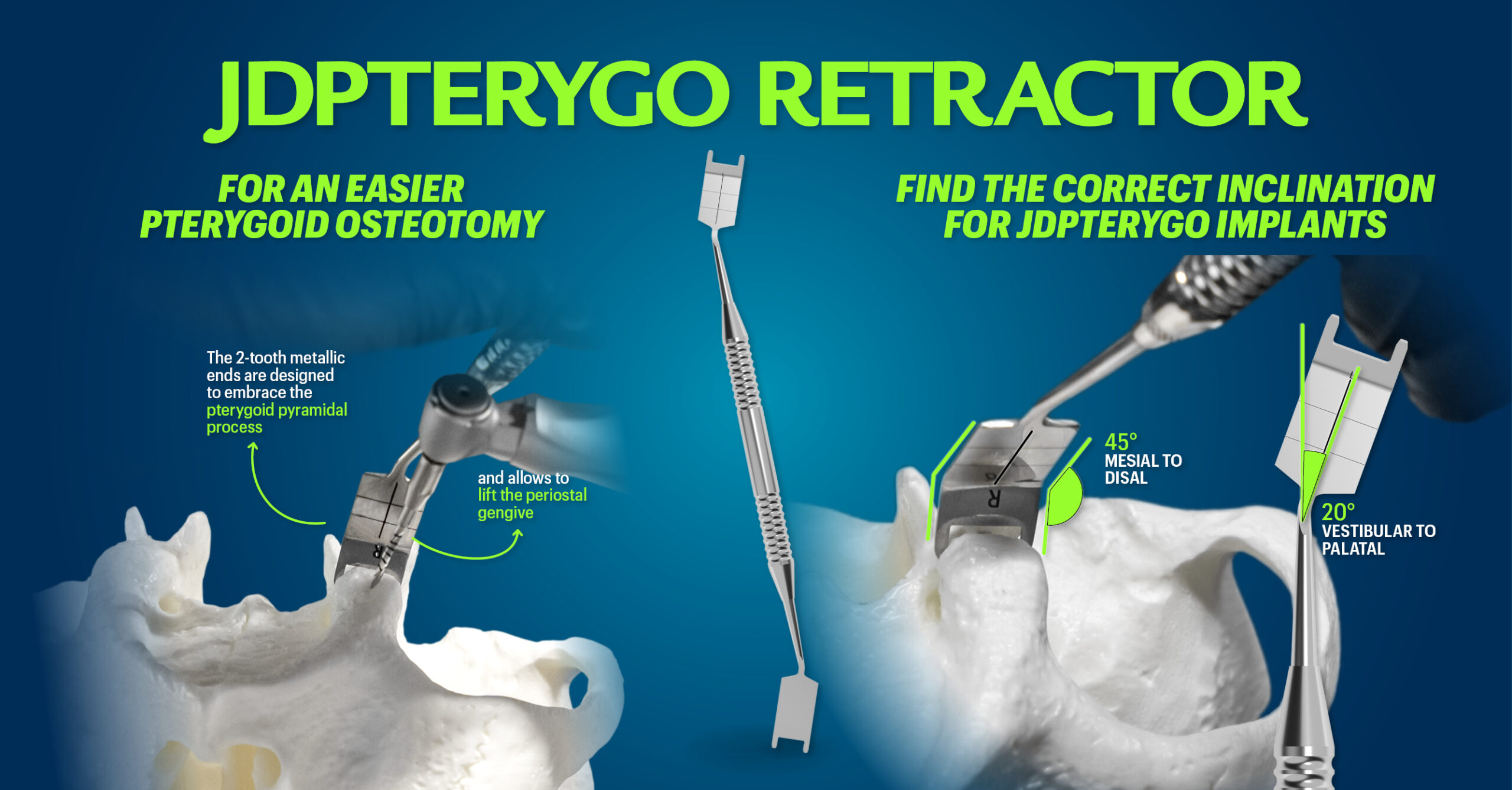 JD PROMO - JDPterygo Retractor English - JDentalCare